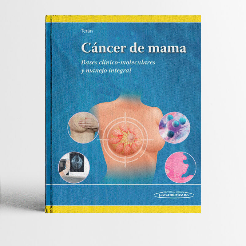 Cáncer de mama bases clínicas y manejo integral – Terán