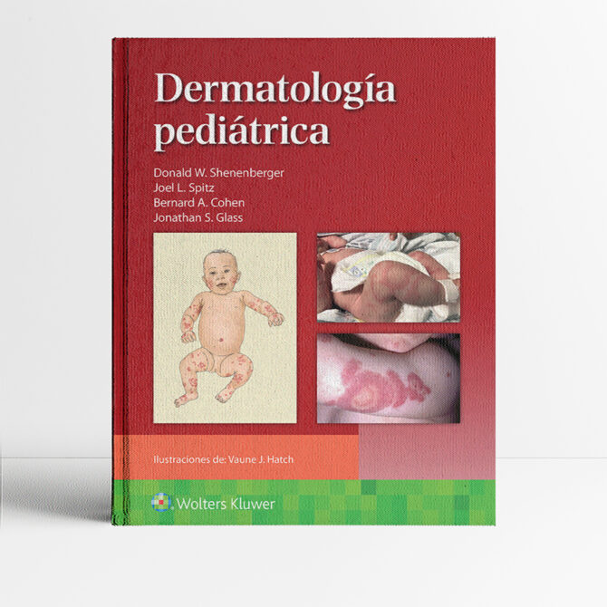 Dermatología pediátrica: diagnóstico clínico | Wolters Kluwer